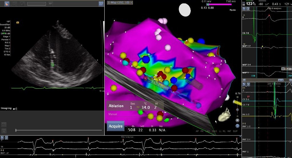 循環器内科－不整脈 - 仙台市立病院